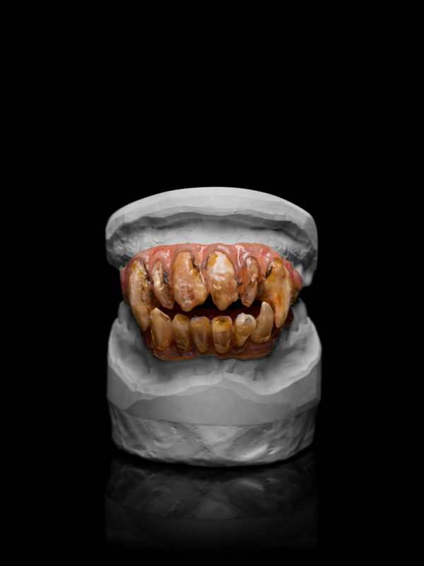 professional vampire teeth from alphabite - BLOOD POISON