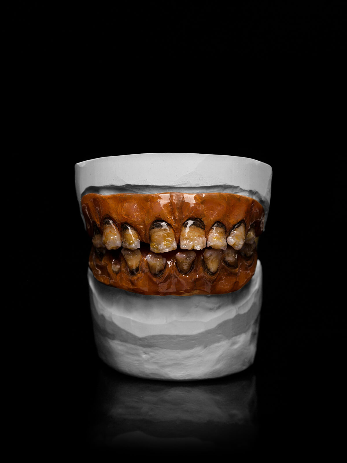 professional vampire teeth from alphabite - MIXED PEAK EMOTION