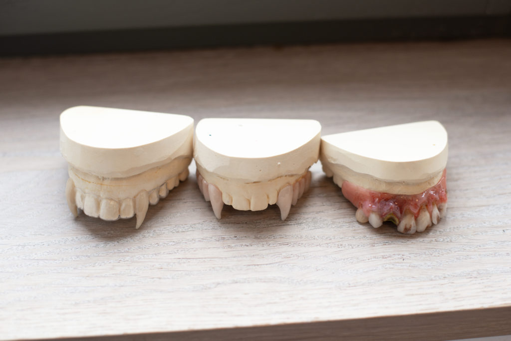 fx teeth systems we use - alphabite