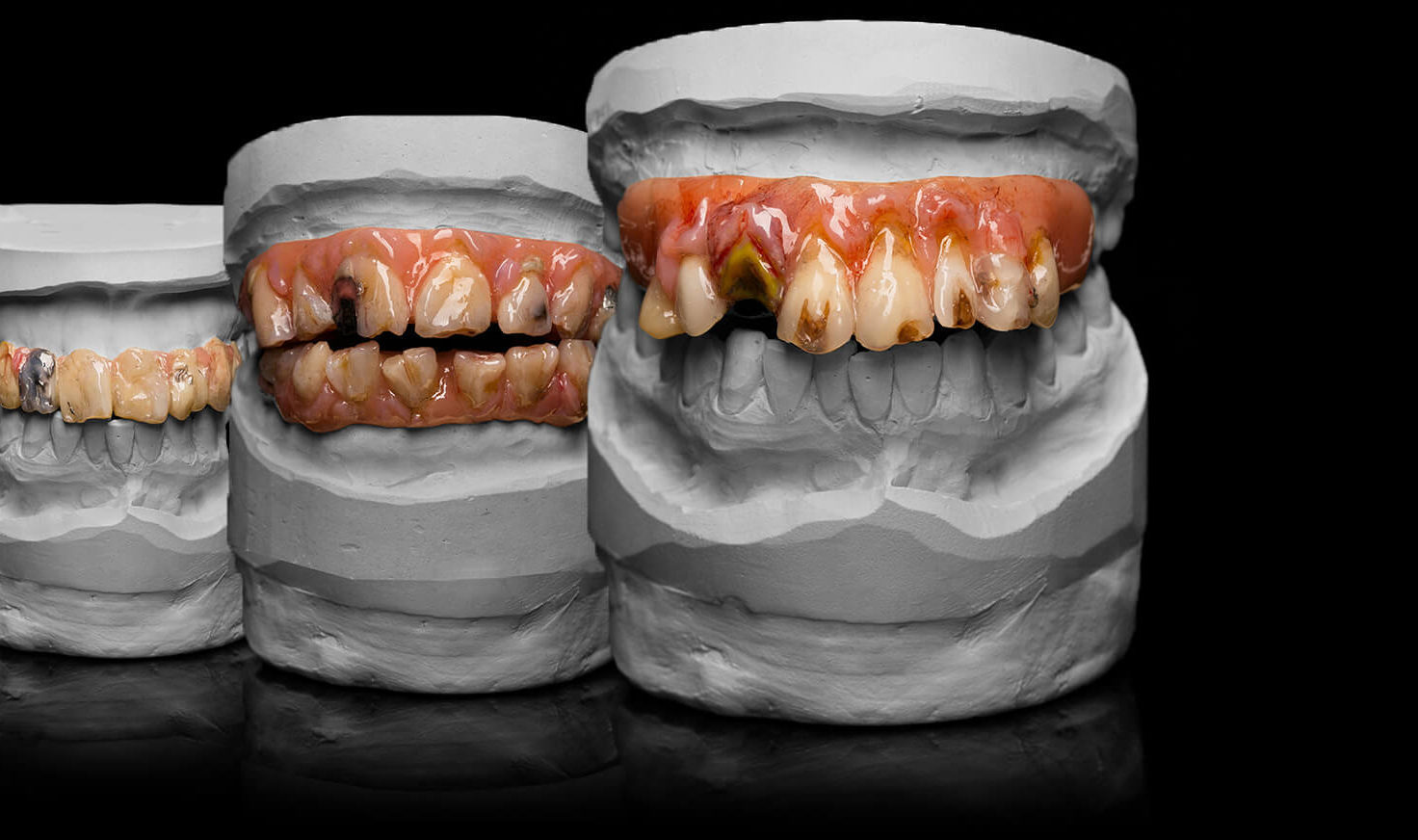 Professional sfx teeth for pro demands - alphabite